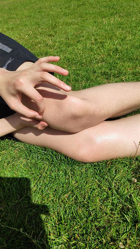 Dislocated My Knee 1 Hour Ago In The Ambulance Rn Thank Fuck For The