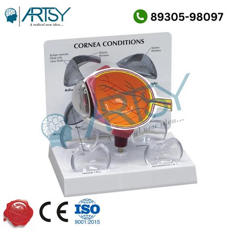 Pvc Cornea Eye Cross Section Model For School At ₹ 3599 In Ambala Id 2854129055412