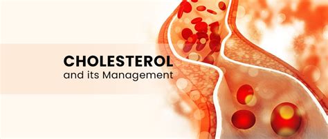 Cholesterol And Its Management