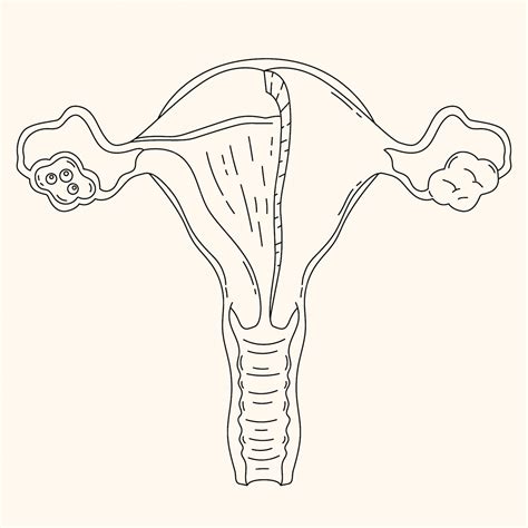 Free Vector Hand Drawn Uterus Drawing Illustration