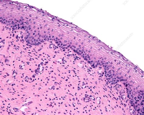 Vaginal Mucosa Light Micrograph Stock Image C046 0582 Science Photo Library