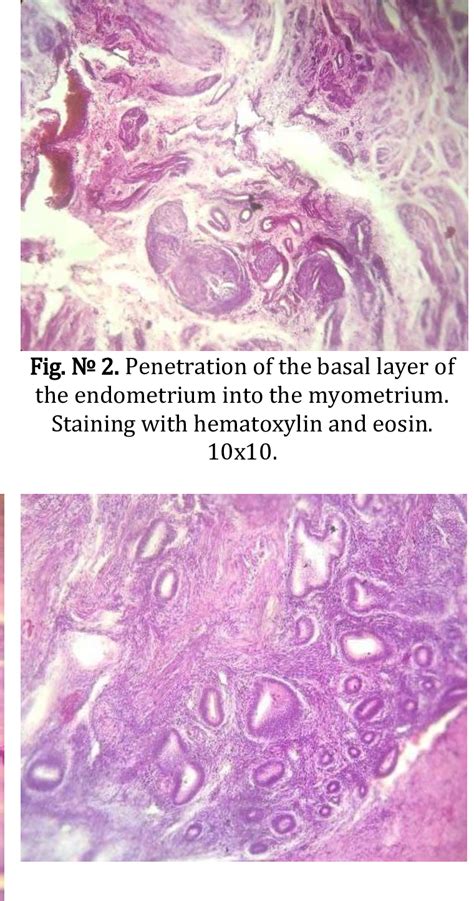 Glandular Structures Of Various Shapes Sizes From Small With A Narrow