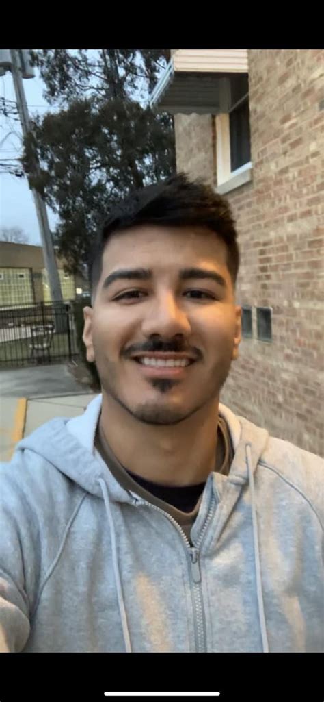 Before After 1 Year Mewing R Mewing