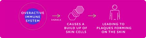 What Is Moderate To Severe Plaque Psoriasis Sotyktu® Deucravacitinib