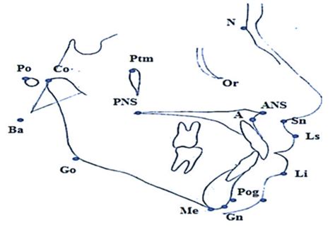 Cephalometric Reference Points Used In The Study Download