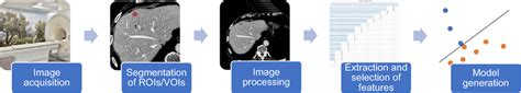 Workflow Of The Different Steps Performed In A Radiomics Analysis