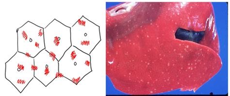 Albumin Test Chimera Medical