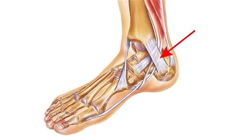 Nilkan Nyrjähdys Näin Kuntoutat Nilkan Ja Ennaltaehkäiset Vammoja Kunto Plus