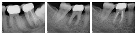 Top Ten Tips Tip Number 2 Diagnosis Endodontic Practice Us