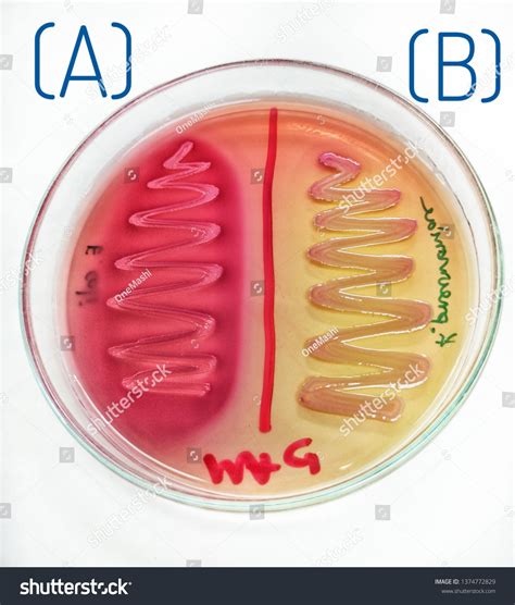Macconkey Agar Enterobacter Aerogenes