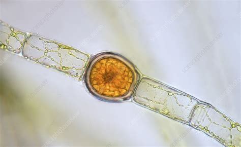 Filamentous Algae With Zygote Light Micrograph Stock Image C060 6610 Science Photo Library