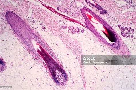Histology Of Human Scalp And Hair Follicle Under The Light Microscope View Human Histology