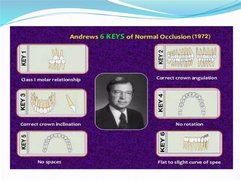 Classification Of Malocclusion Pptx
