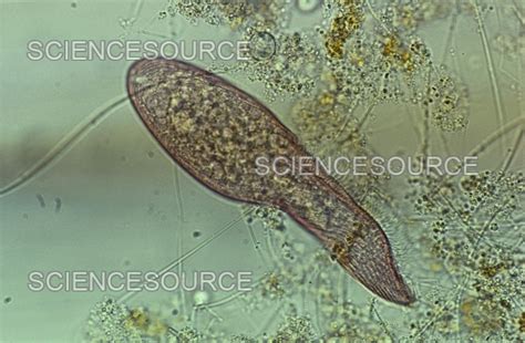 Blepharisma Labeled Diagram