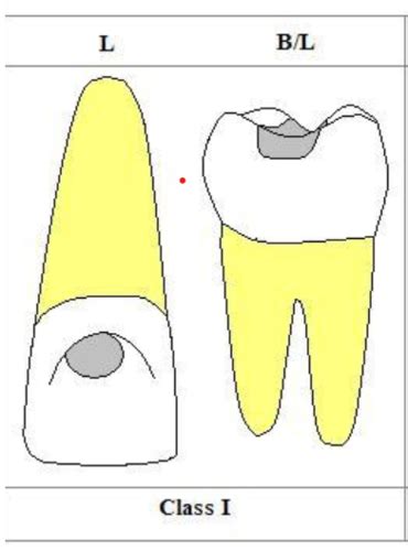 Classification Of The Teeth Flashcards Quizlet