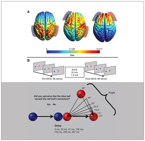 A Transcranial Direct Current Stimulation Tdcs Conditions Showing Download Scientific