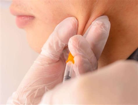 Masseter Botox For Tmj Relief That Actually Works