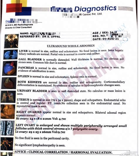 Cases Pcod Suntex Clinic