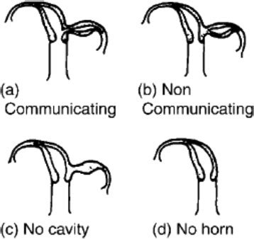 Sonographic Findings Of Early Pregnancy In The Rudimentary Horn Of A