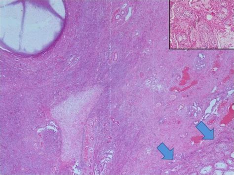 Disorders Of Sex Development A Study Of 194 Cases Pmc