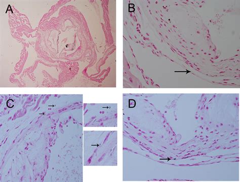 Calcification In The 56 Week Old Apoe Mice Aorta Artery By Von Kossa Download Scientific