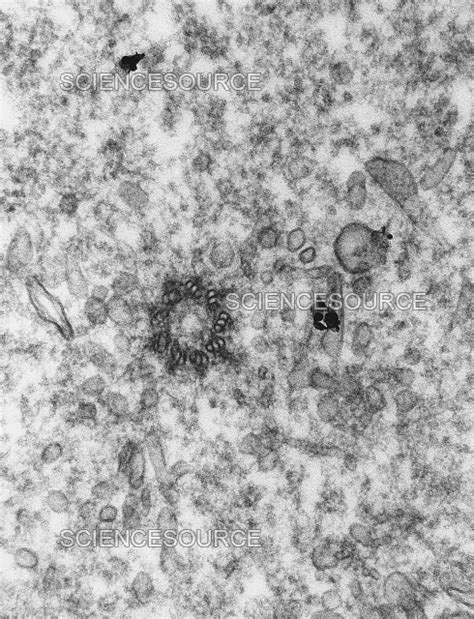 Centrioles Micrograph