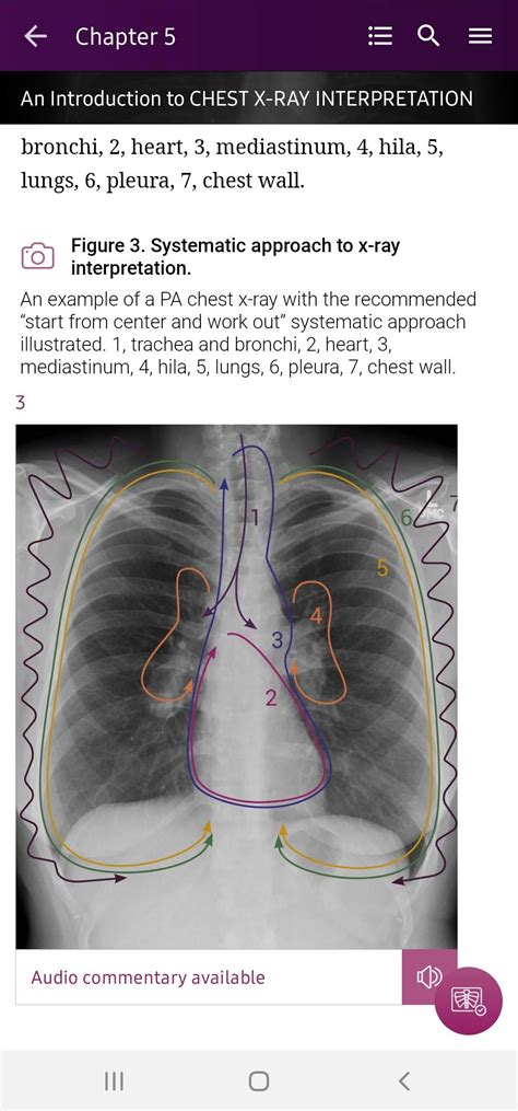 Chest X Ray Interpretation Latest Version 133 For Android