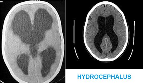 Doctors Network Ct Scan Of Head