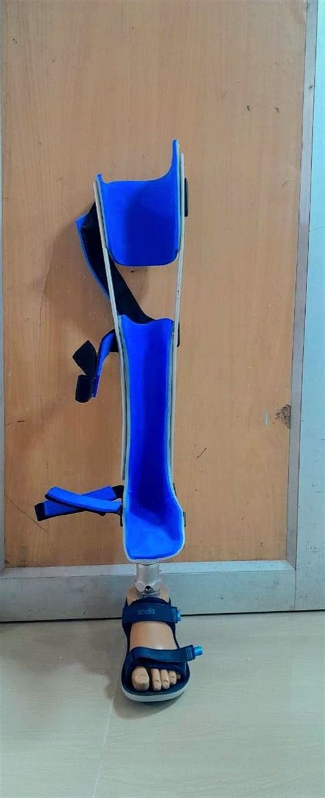 Arulmozhi Selvan V On Linkedin Completed My 1st Extension Prosthesis For Congenital Leg Length…