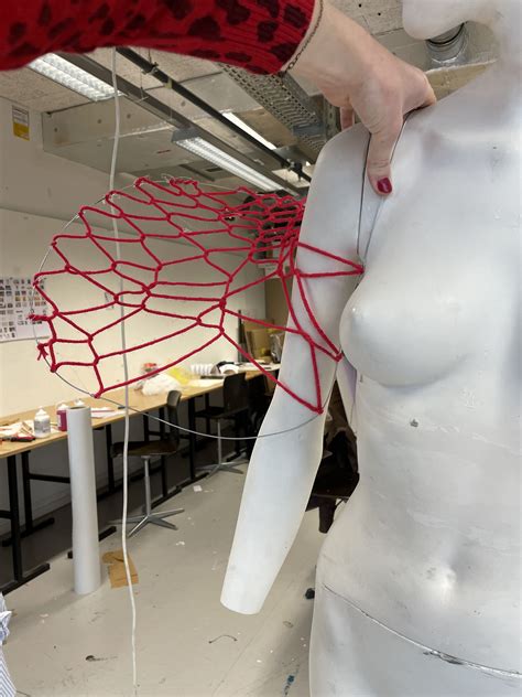 Cortex 3d Printed Cast For Fractured Bones By Jake Evill Artofit