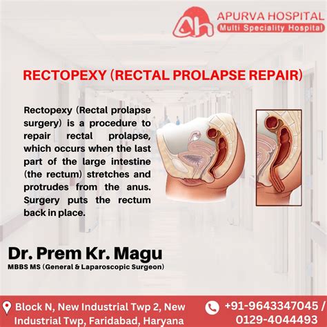 👉rectopexy Rectal Prolapse Repair Apurva Hospital Facebook