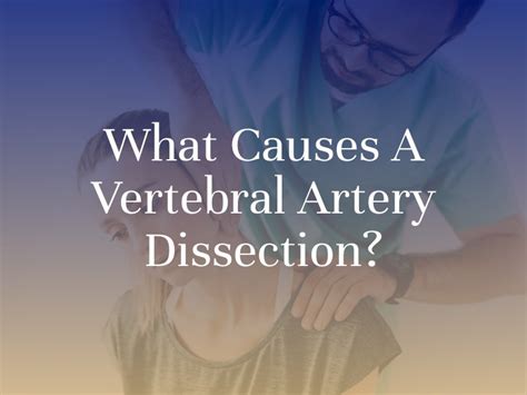 What Is A Vertebral Artery Dissection