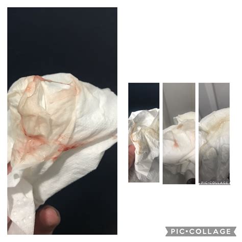 Implantation Bleeding With Ovulation Calendar Ovulation Calendar And