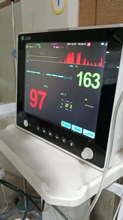 Premature Needs Ventilator Support On Ambubagging Video Reels Shorts Youtube