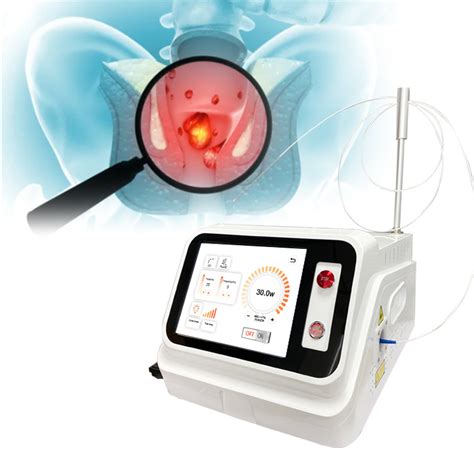 1470nm 980nm Diode Laser For Hemorrhoids Treatment Proctology Fistula