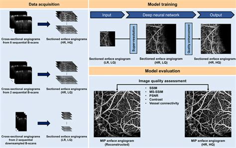 Schematic Of Our Deep Learning Dl Framework For Accelerated Optical Download Scientific