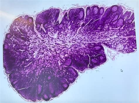 Hist Lymph Lab Flashcards Quizlet