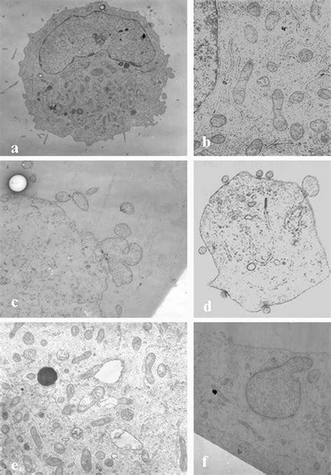Transmission Electron Microscopy Of Prostate Cancer Cells A Control