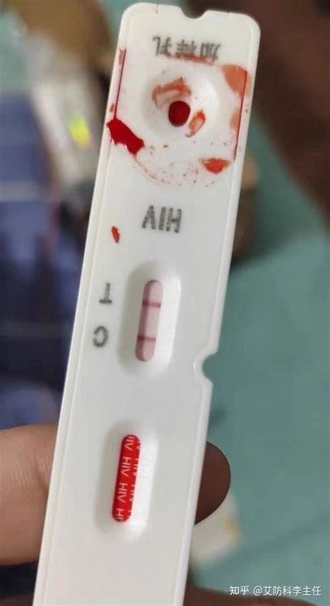 关于hiv试纸检测问题的全面科普 知乎