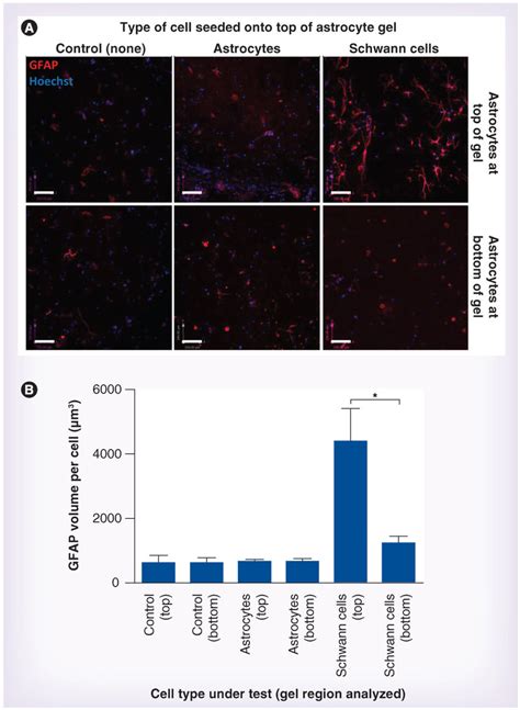 Astrocyte Reactivity In Response To Control Cells Download Scientific