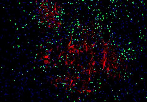 1 Tsa Fluorescence Double Staining Kit A Type 100t 50μl 980