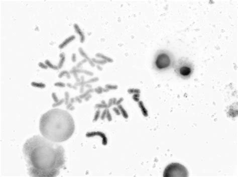 Non Specific Dapi Staining In Fish Researchgate