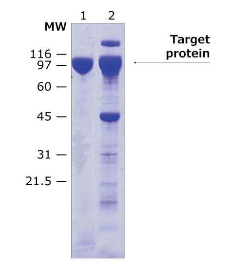Tag Removal Proteases For Recombinant Protein Purification