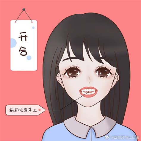牙齿 口腔 漫画 插画 卡通 牙齿矫正 牙齿疾病 牙齿稀疏 牙齿错乱 反颌 牙列拥挤 中线不齐 开颌 牙齿缺损 深覆合 龅牙 牙齿不齐 偏颌 虎牙 口腔种植 口腔美学正畸 改善龅牙不整齐 对刃