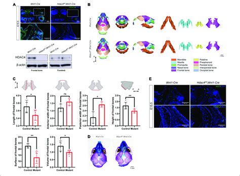 The Conditional Knockout Of Hdac4 In Cranial Neural Crest Cells
