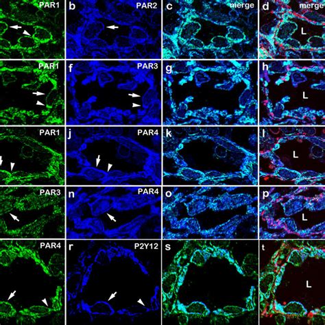 Laser Scanning Microscopy Of Triple Immunostaining For Mif Tm And