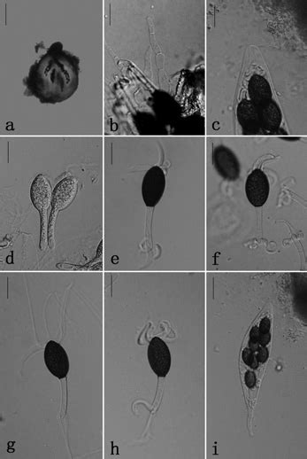 Podospora Communis A Perithecium B Paraphyses C Upper Part Of The