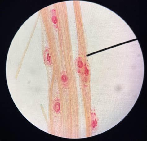 Micro Block 4 Flashcards Quizlet