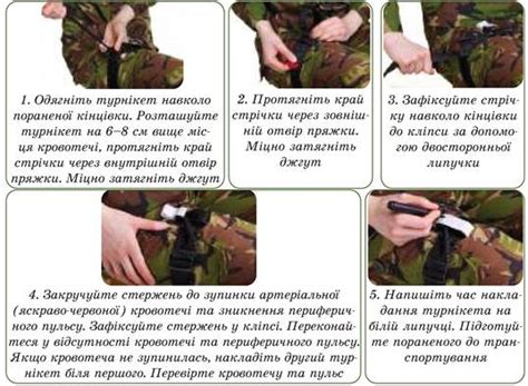 Техніка накладання турнікета на верхні та нижні кінцівки Захист