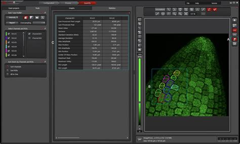 Image Analysis Using The Leica Application Suite X Software Download High Resolution